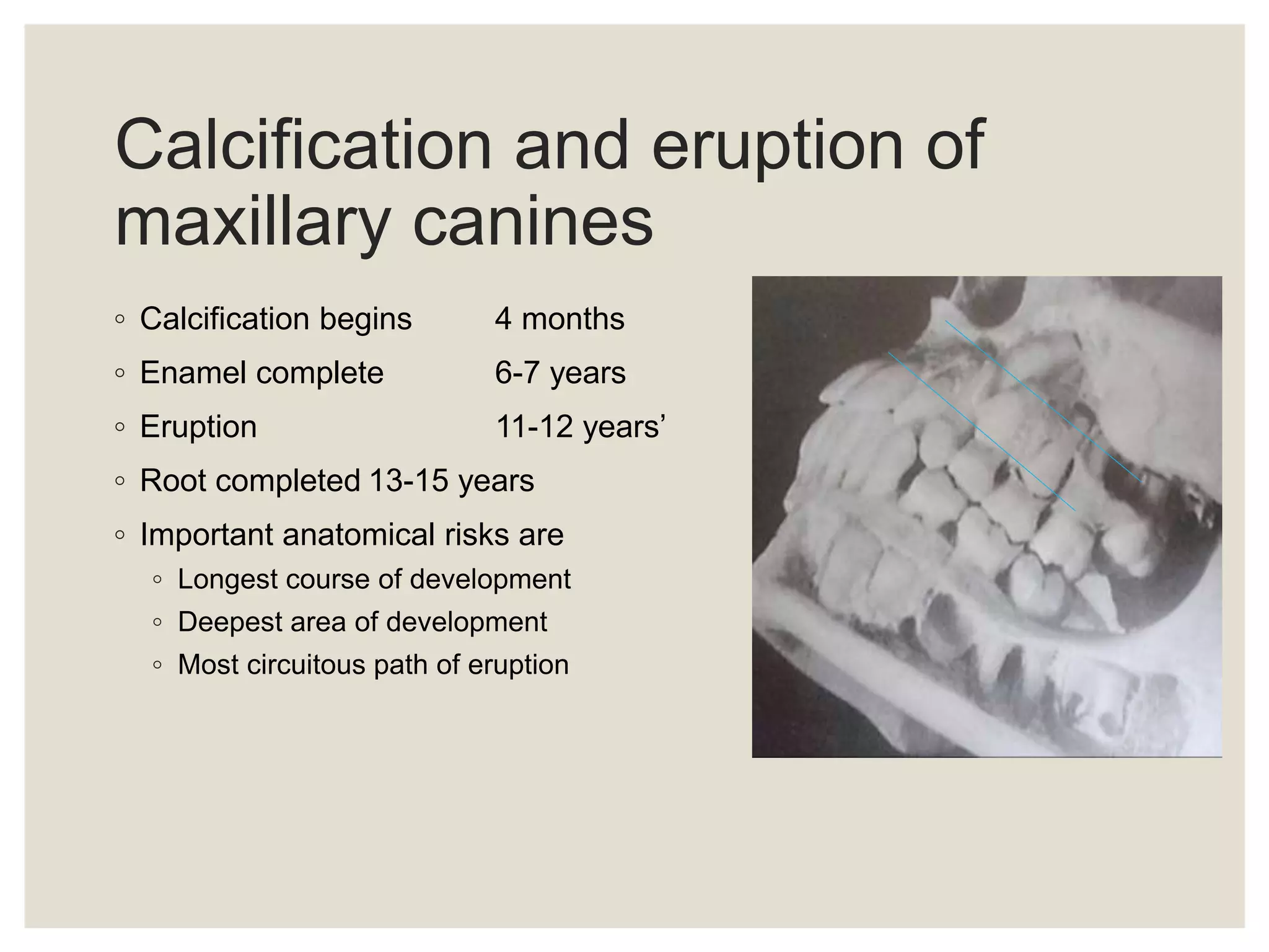 orthodontic management of impacted canine. | PPTX