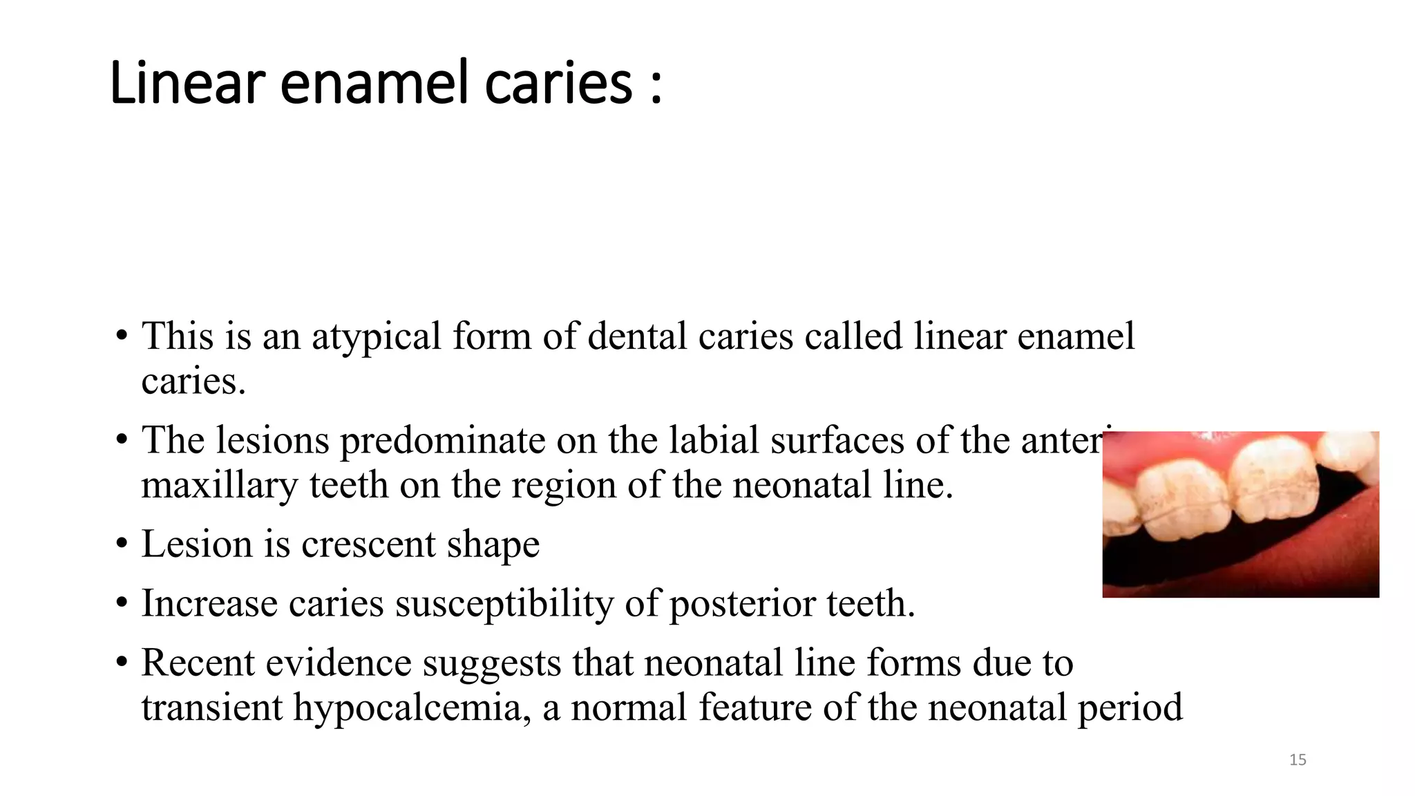 dental caries classifications, histopathology | PPTX