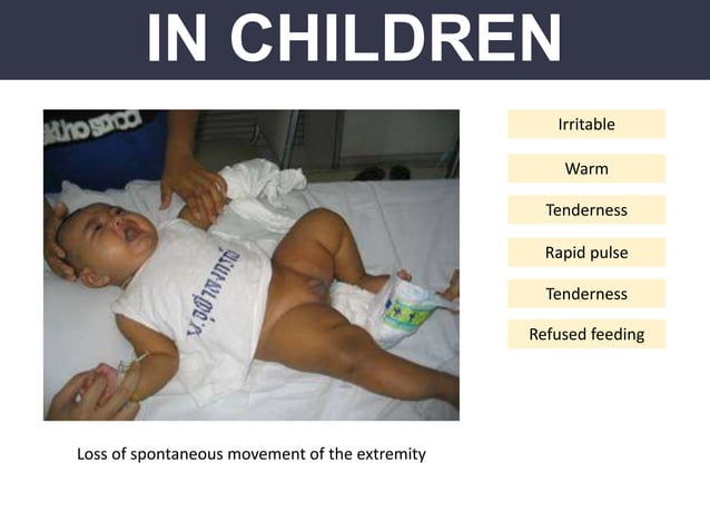 Septic Arthritis | PPTX