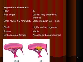 6.Infective endocarditis pathology | PPT