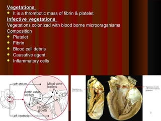 6.Infective endocarditis pathology | PPT