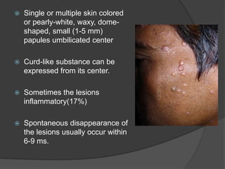 6. Viral infections | PPT