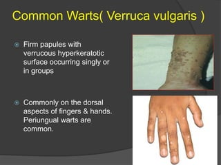 6. Viral infections | PPT