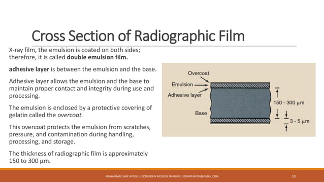 Screen Film Radiography