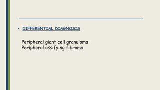 Pyogenic granuloma | PPTX