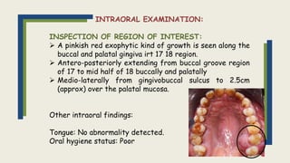 Pyogenic granuloma | PPTX