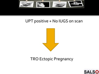 Bleeding in Early Pregnancy Update April 2019 | PPT