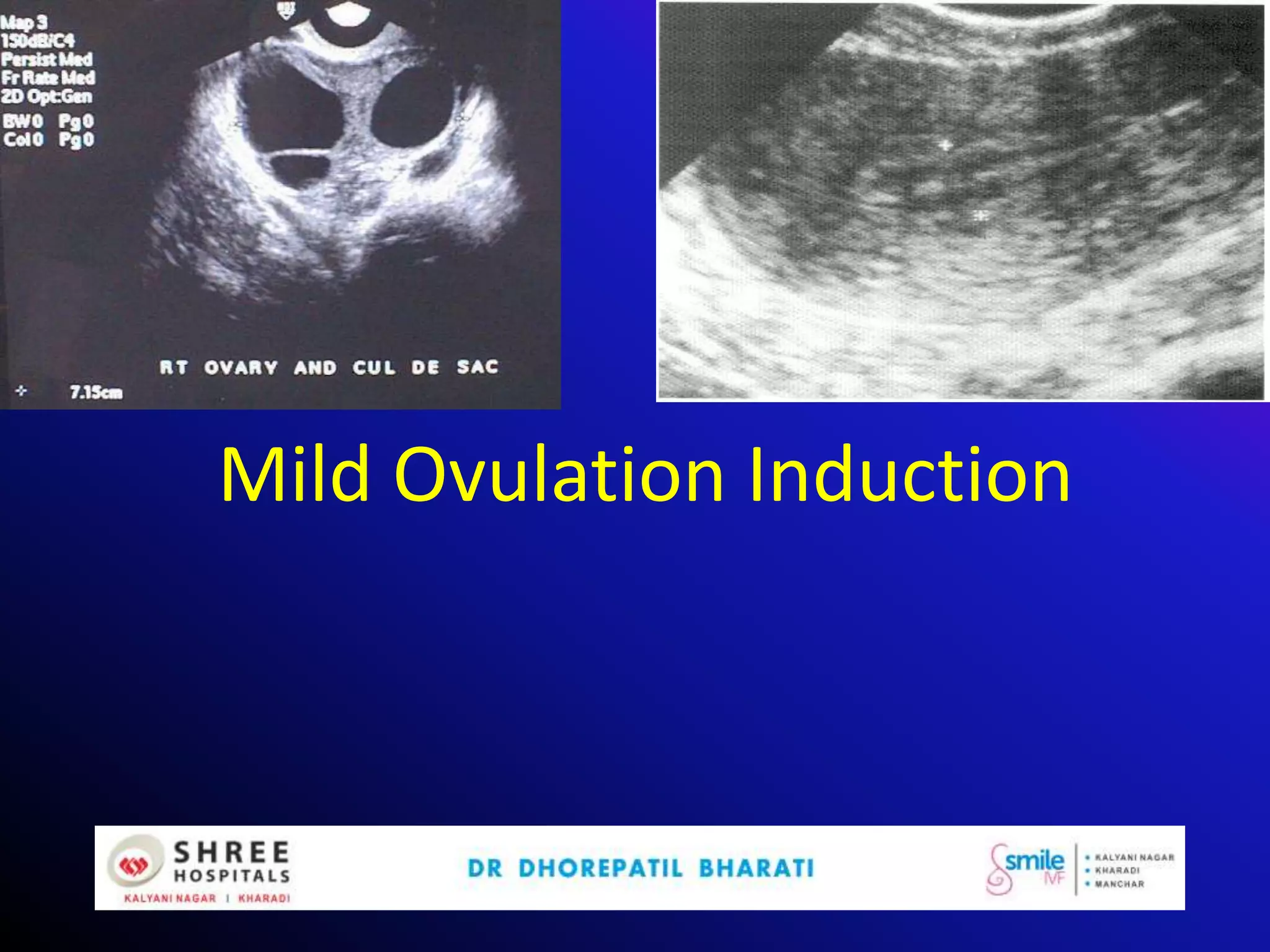 Ovulation Stimulation Protocols For Iui Ppt