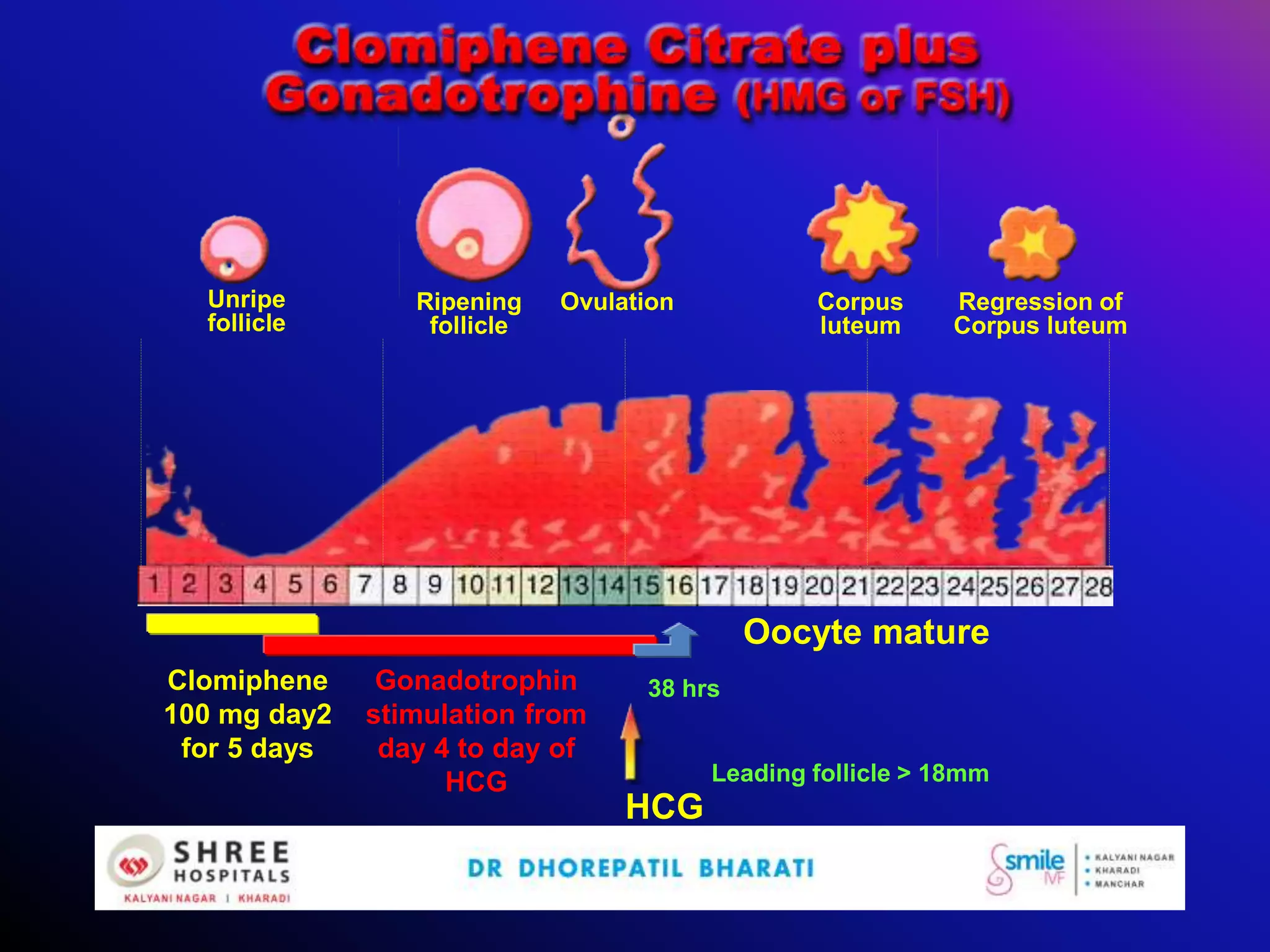 Ovulation Stimulation Protocols for IUI | PPTX