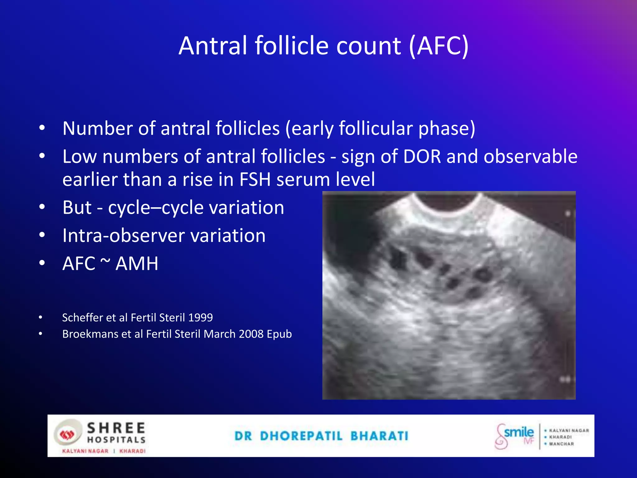 Ovulation Stimulation Protocols for IUI | PPTX