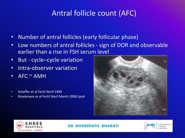 Ovulation Stimulation Protocols for IUI | PPTX