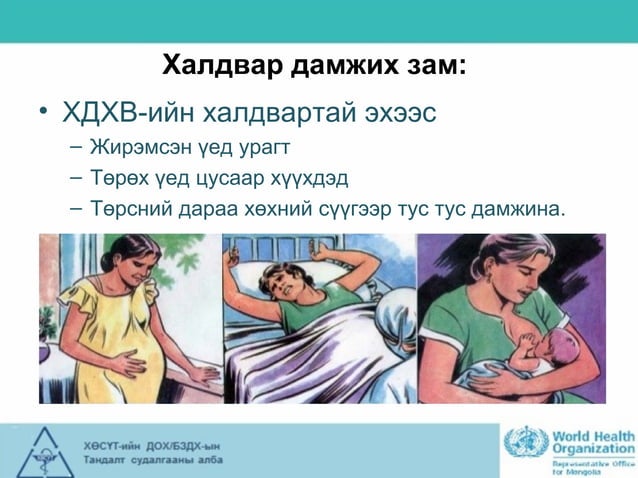 6 ХДХВ ийн халдвар дамжих зам эрсдэл нөлөөлөх хүчин зүйл Ppt