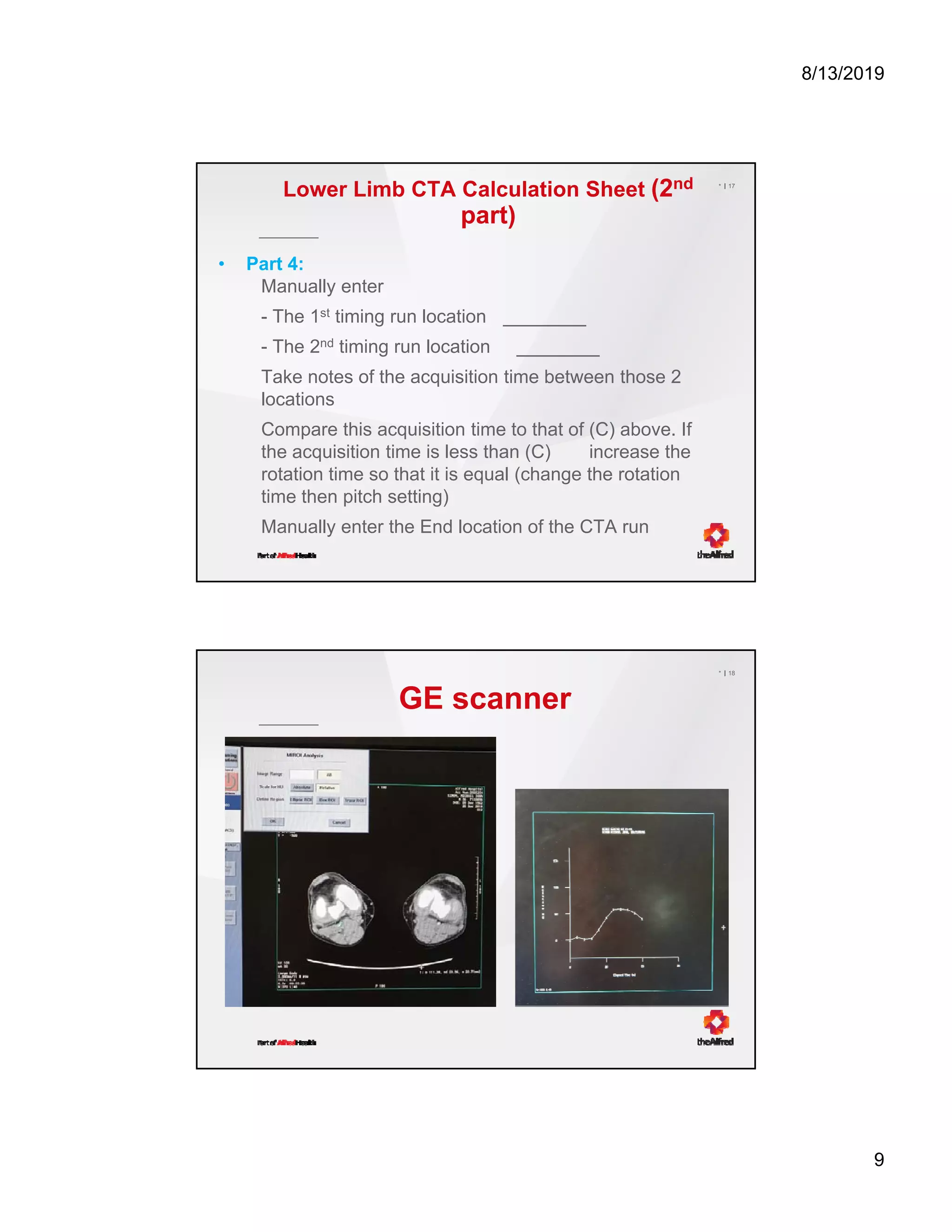Ky thuat CT mach mau chi duoi, Ngon Tran (EN) | PDF