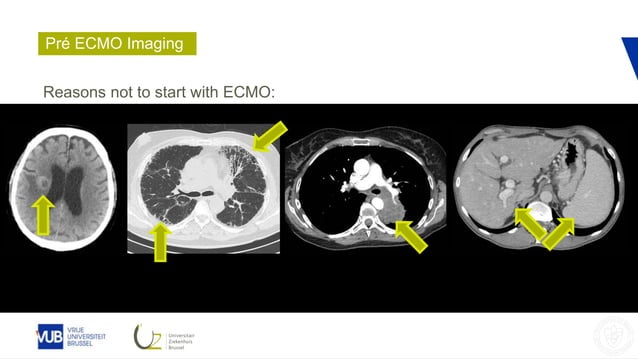 6. radiologic imaging in ecmo #beach2019 (nieboer) | PPT