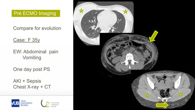 6. radiologic imaging in ecmo #beach2019 (nieboer) | PPT