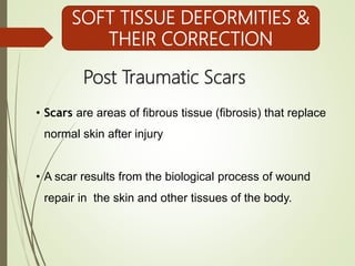 residual deformity correction in maxillofacial trauma | PPTX
