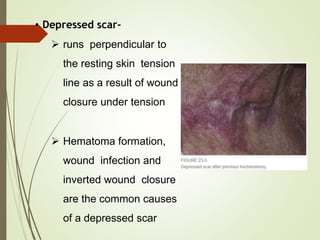 residual deformity correction in maxillofacial trauma | PPTX