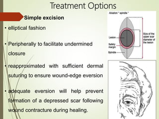 residual deformity correction in maxillofacial trauma | PPTX