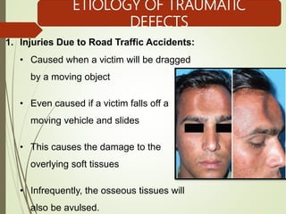 residual deformity correction in maxillofacial trauma | PPTX