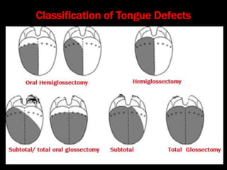 Neoplasms of the oral cavity | PPT