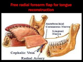 Neoplasms of the oral cavity | PPT