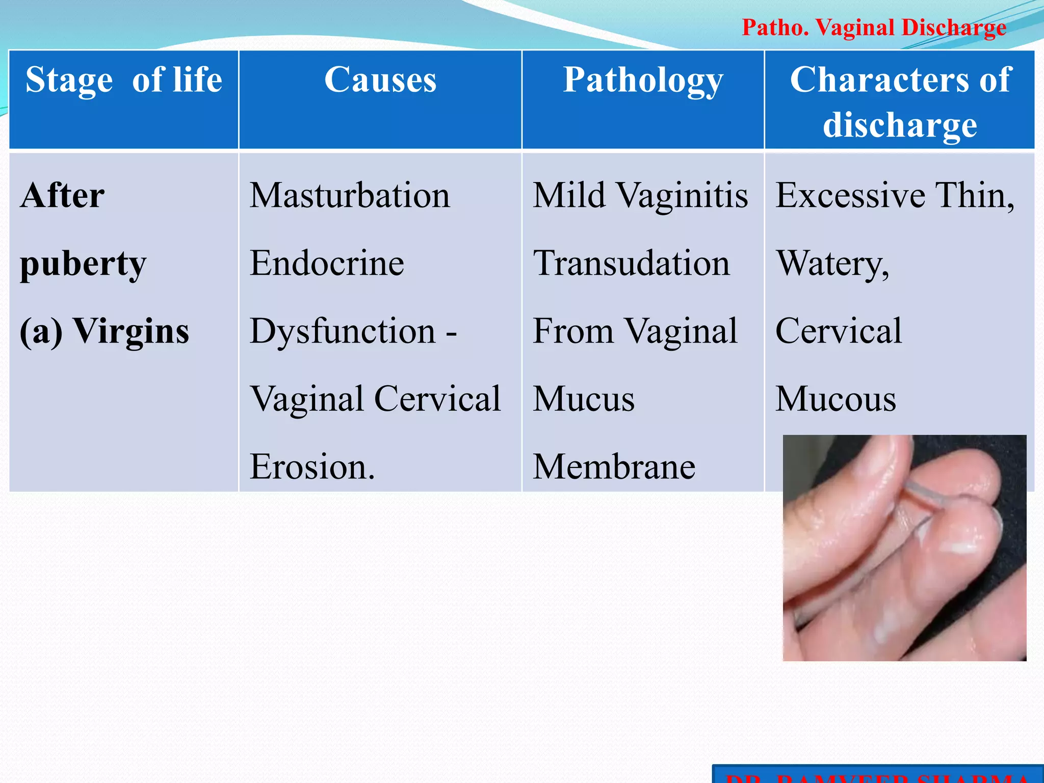 Vaginal Discharge, Pathological Leucorrhoea, Vaginal defense mechanism ...