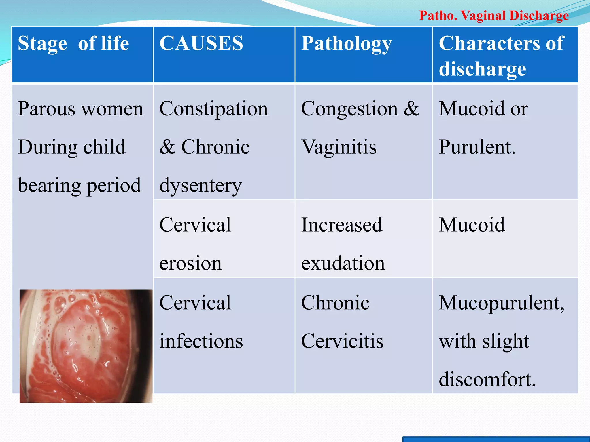 Vaginal Discharge, Pathological Leucorrhoea, Vaginal defense mechanism ...
