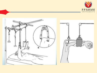 6. Humerus lower end fractures | PPTX