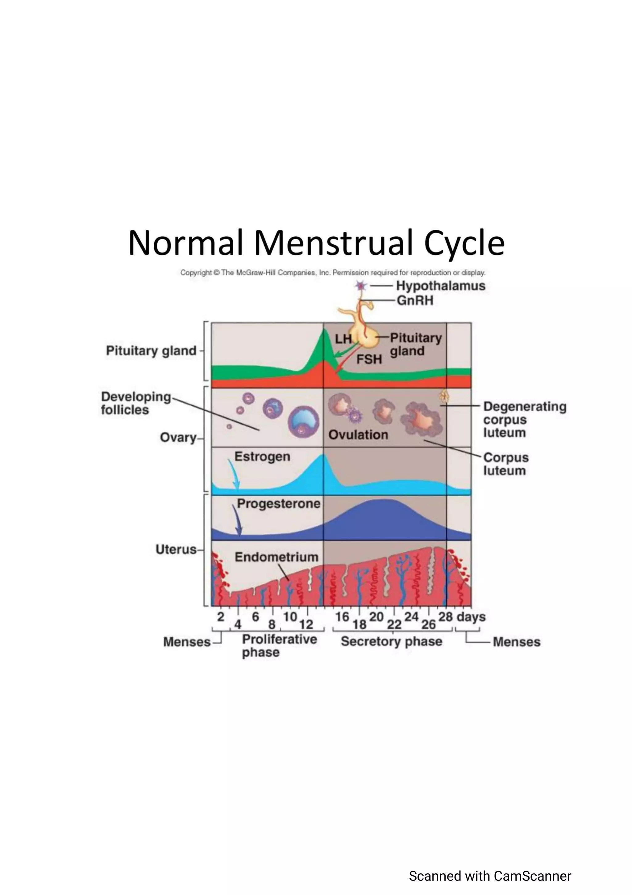 Disorders Of Menstrual Cycle 【Dysfunctional Uterine Bleeding】 | PDF ...