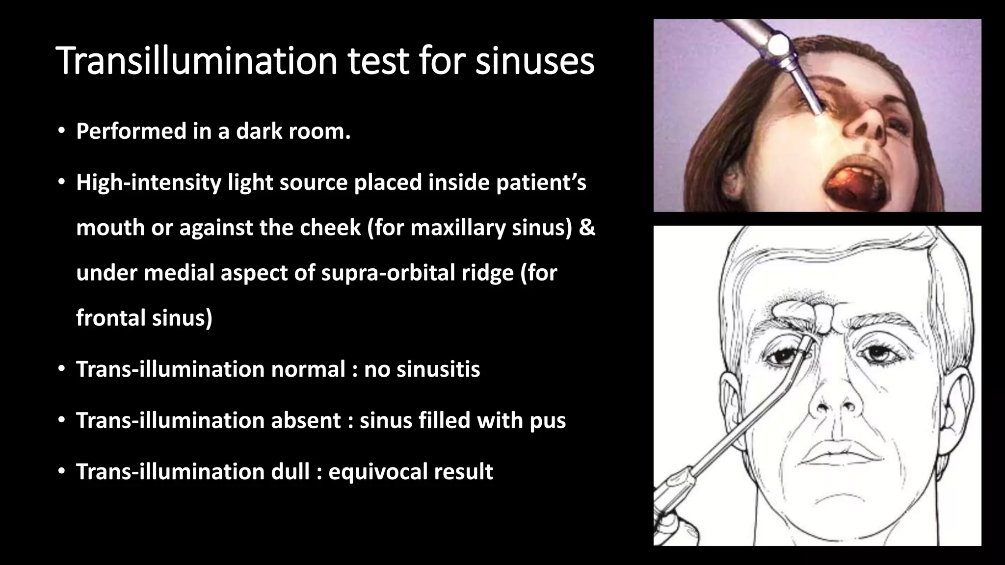 Rhinosinusitis: clinical features and diagnosis kk | PPTX
