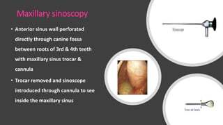 Rhinosinusitis: clinical features and diagnosis kk | PPTX