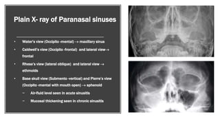 Rhinosinusitis: clinical features and diagnosis kk | PPTX