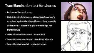 Rhinosinusitis: clinical features and diagnosis kk | PPT
