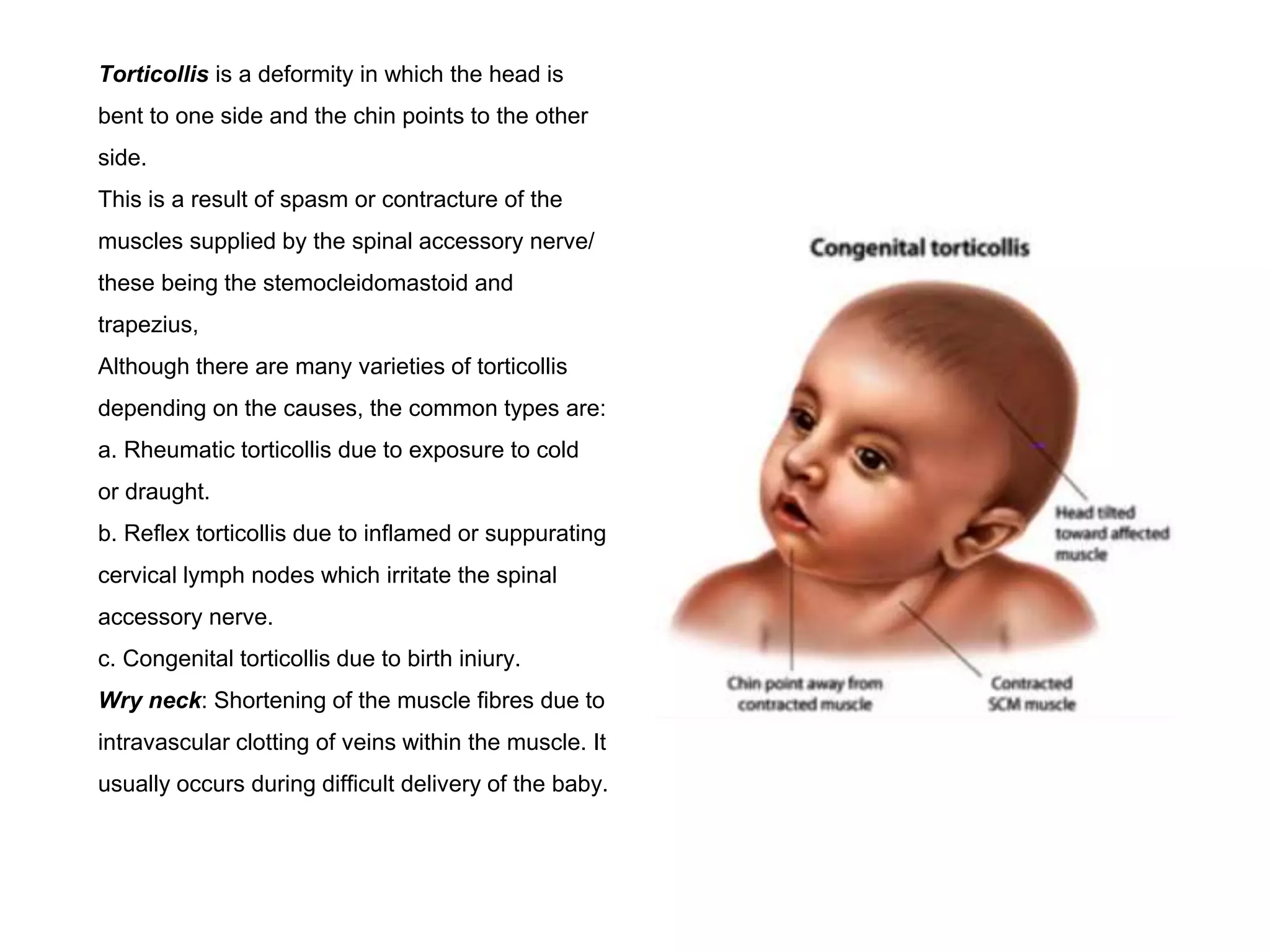 Sternocleidomastoid muscle | PPTX