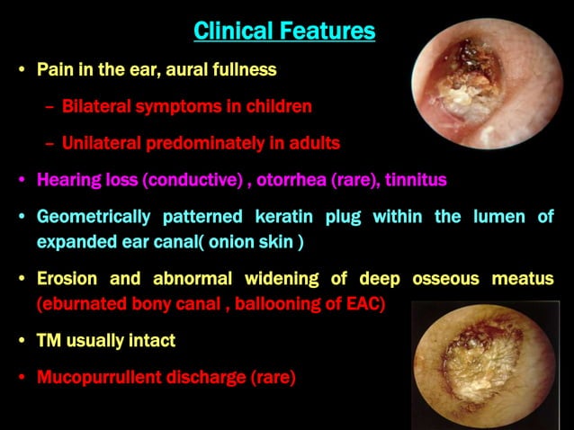 6. diseases of the external ear | PPT