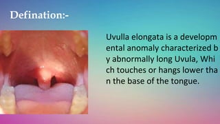uvula elongata | Anomalies of lips and palate |Developmental anomalies ...