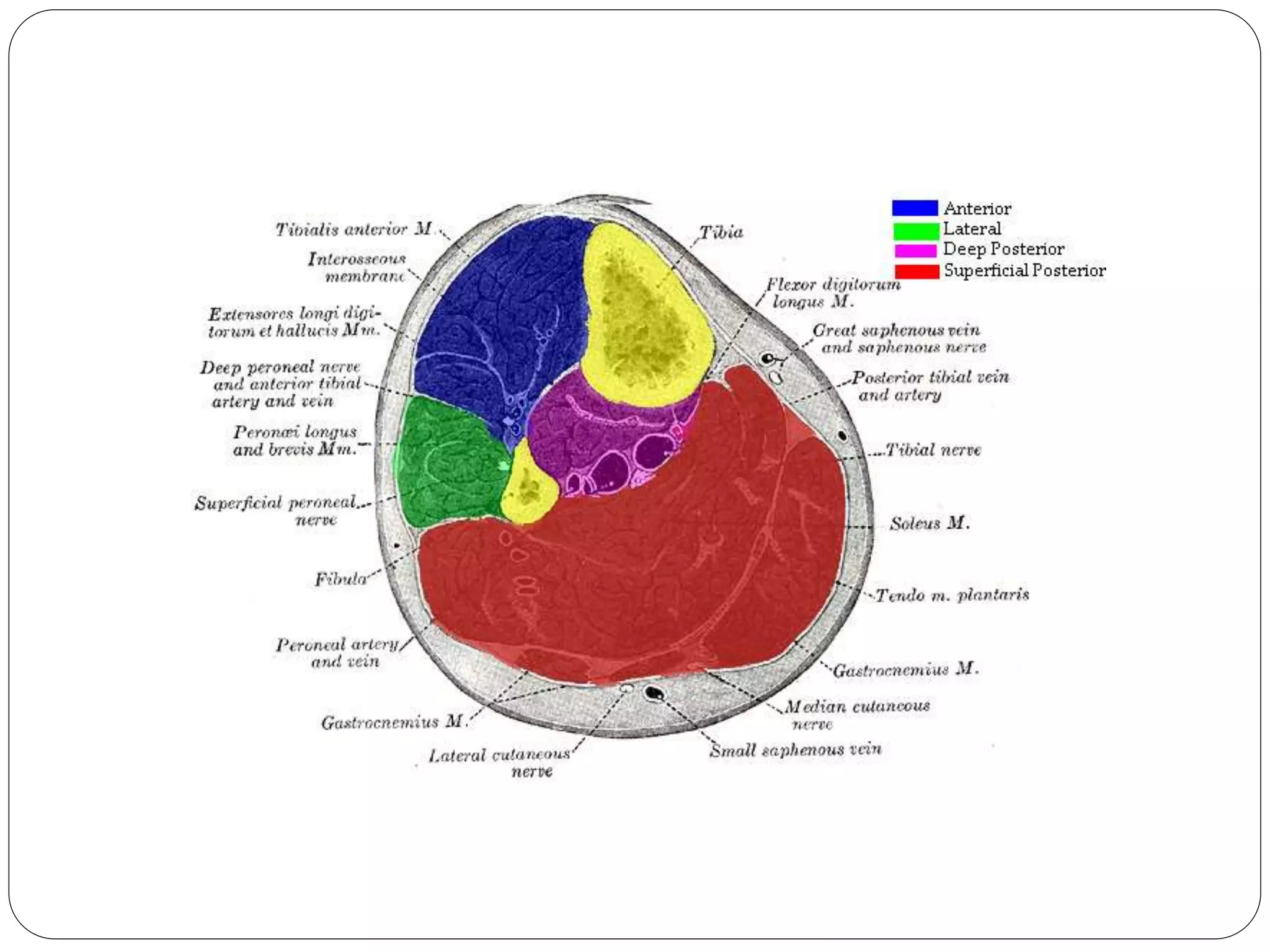 Fracture shaft of tibia | PPTX