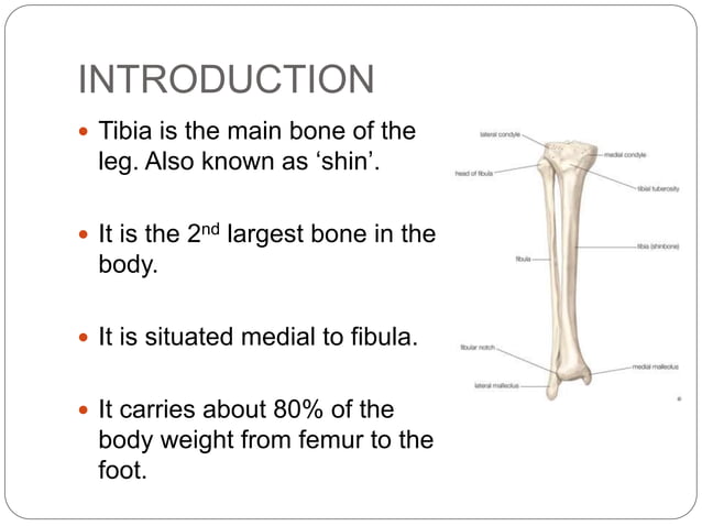 Fracture shaft of tibia | PPTX