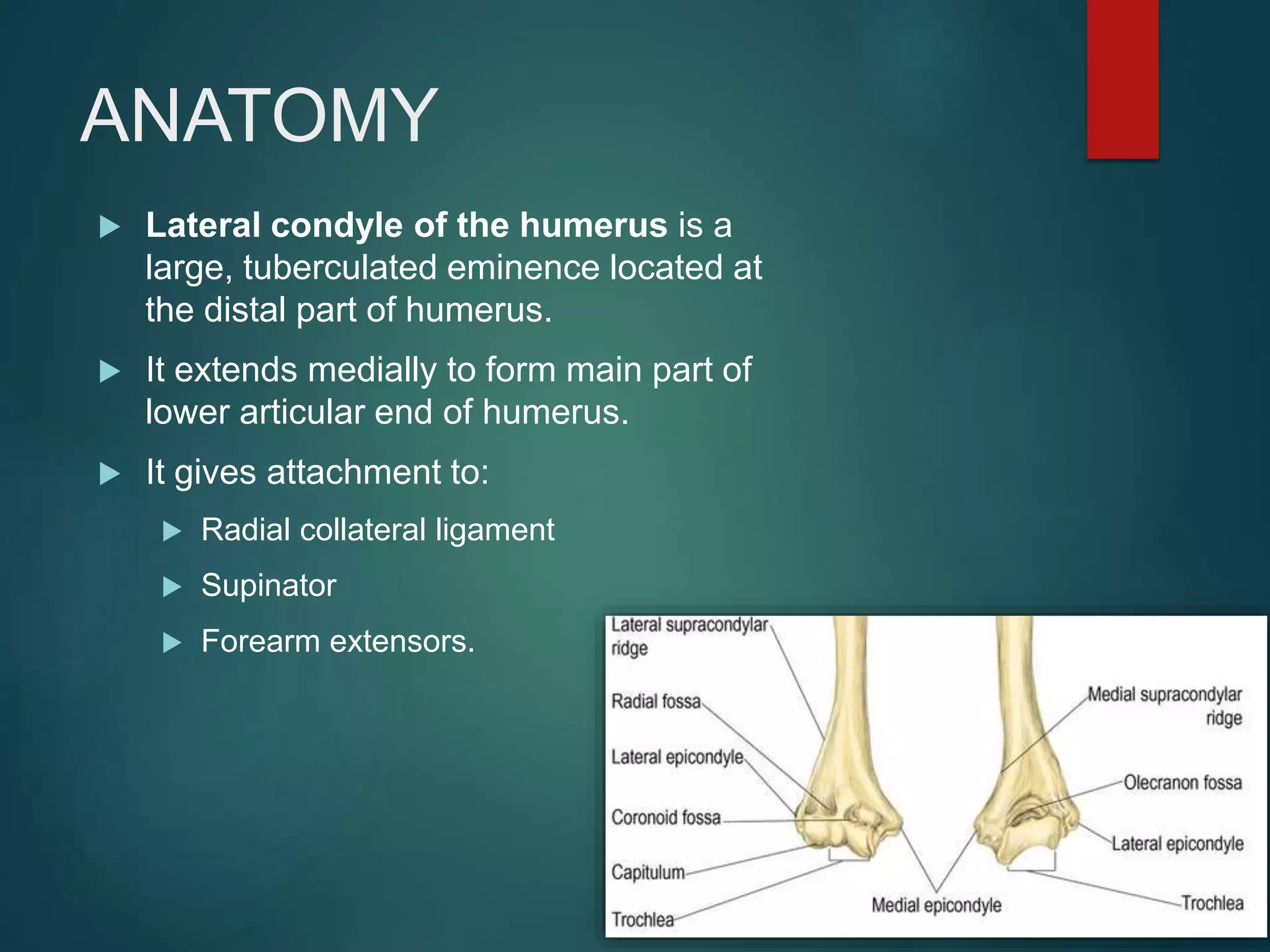 Lateral condyle fracture humerus | PPTX