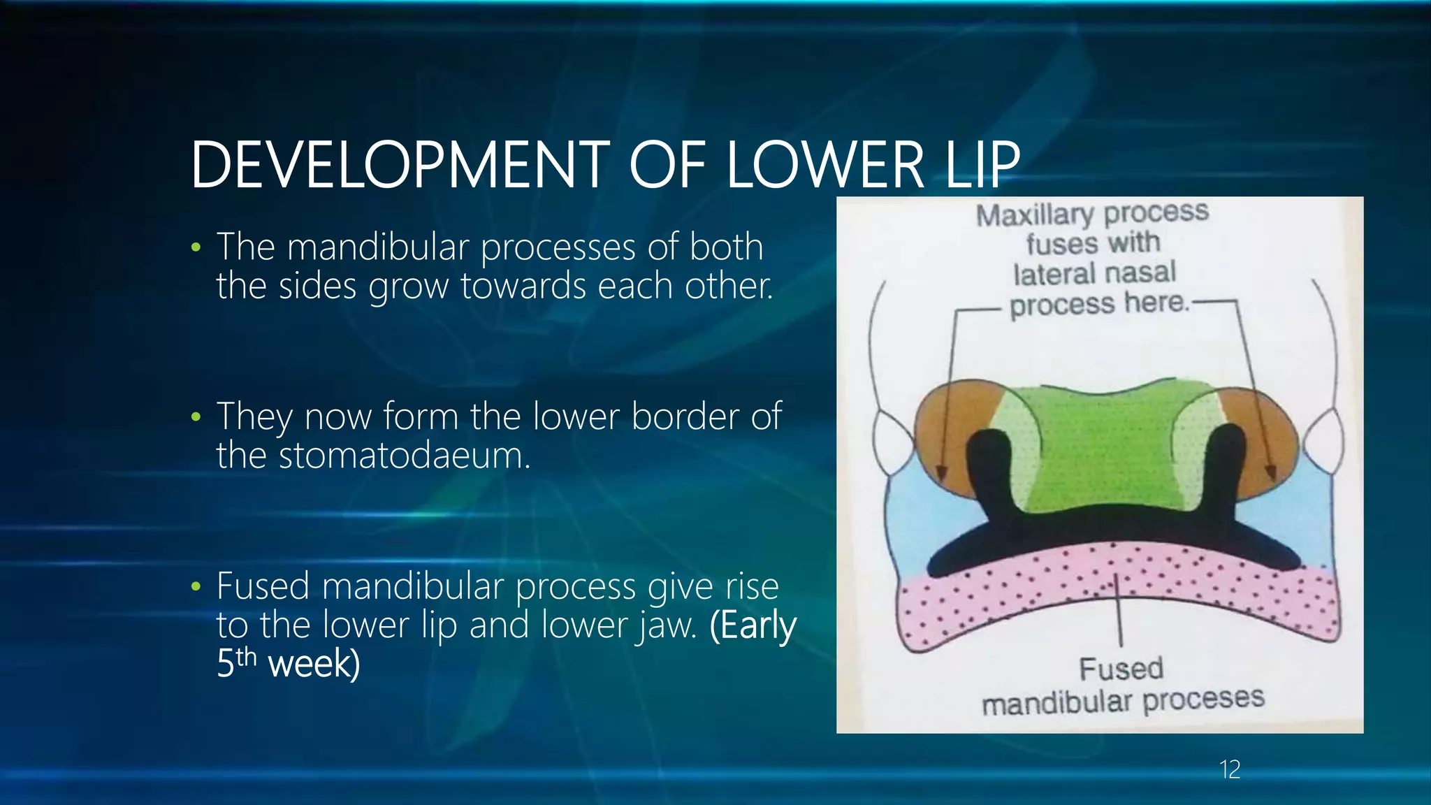 Cleft Lip and Cleft Palate | PPTX