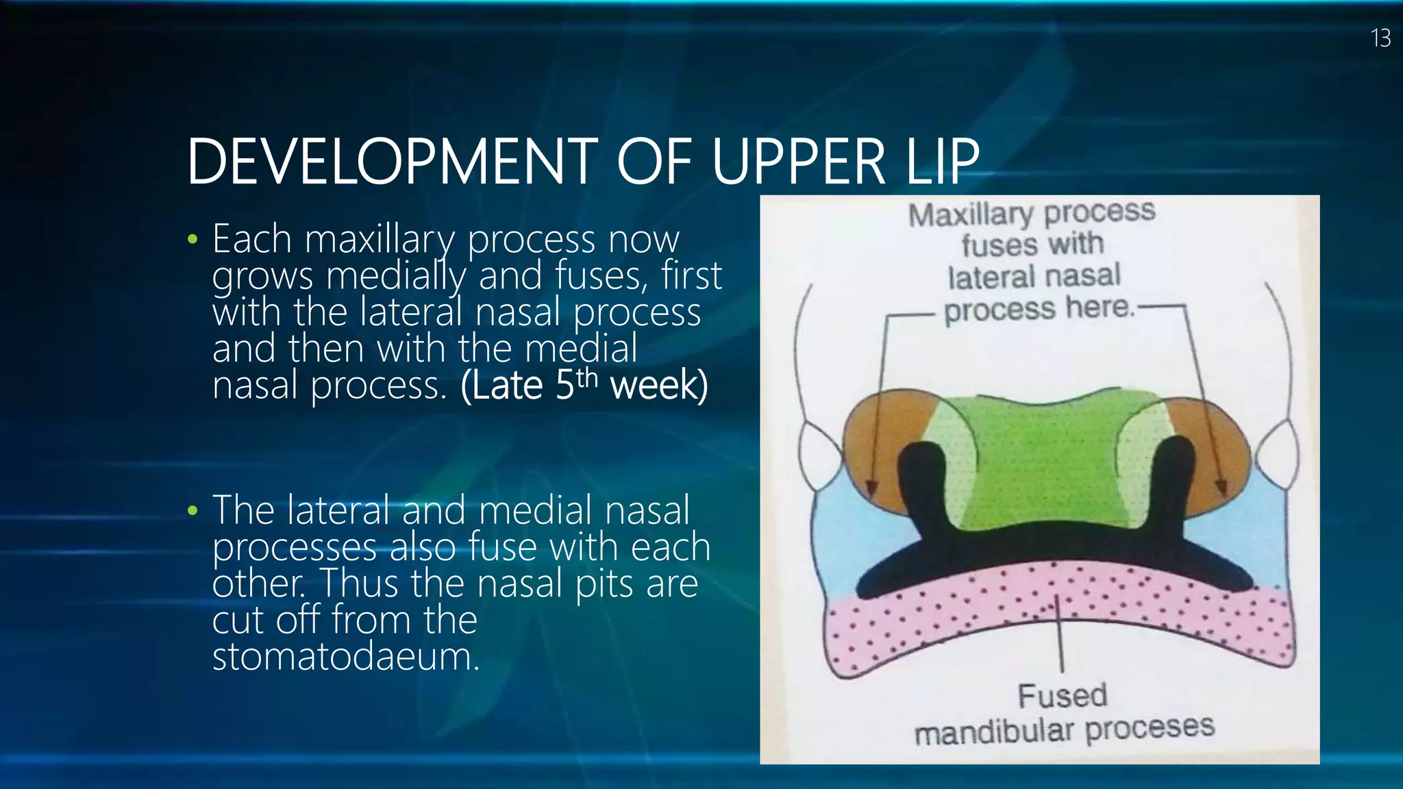 Cleft Lip and Cleft Palate | PPTX | Ear, Nose and Throat Conditions ...