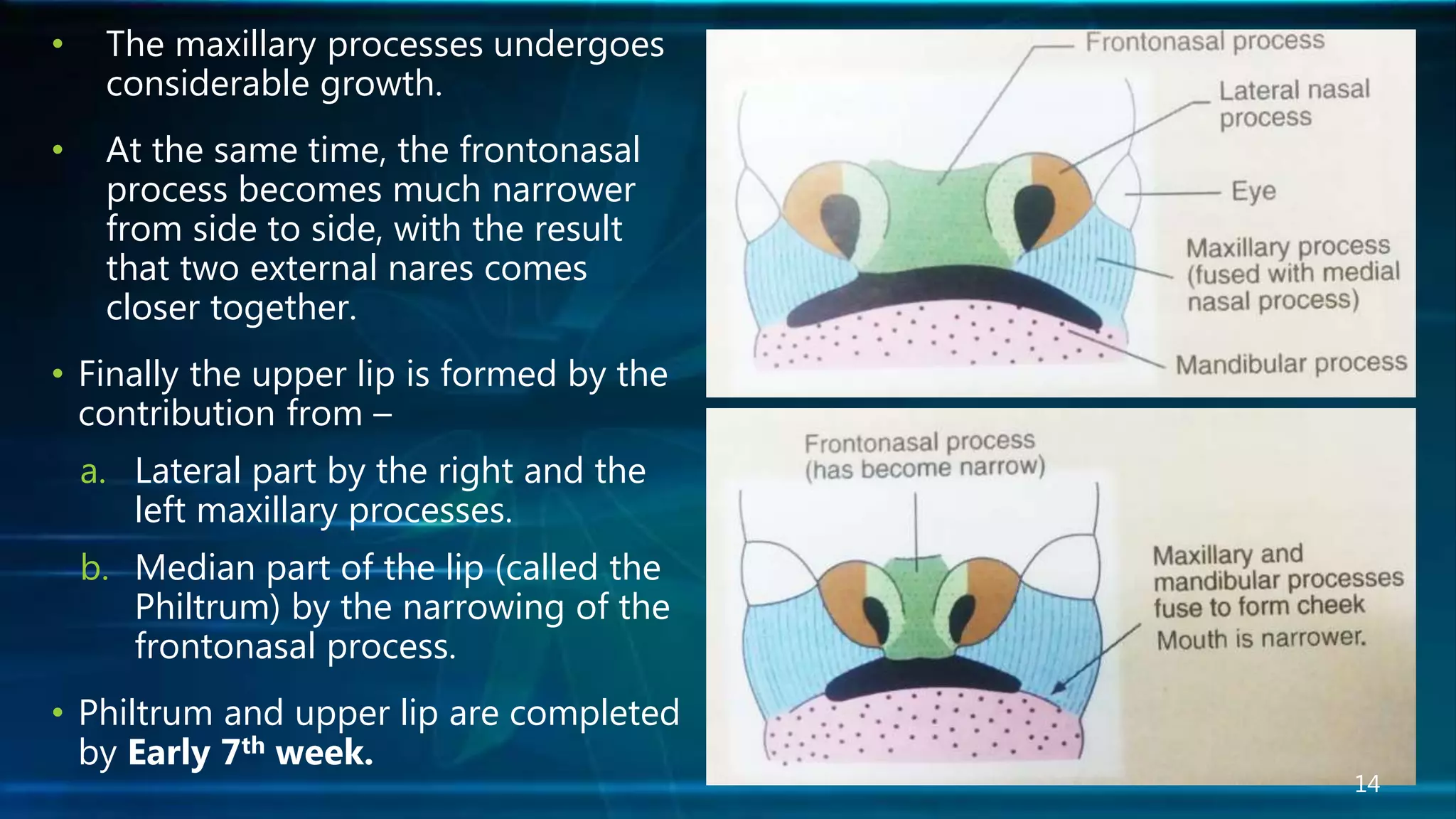Cleft Lip and Cleft Palate | PPTX | Ear, Nose and Throat Conditions ...