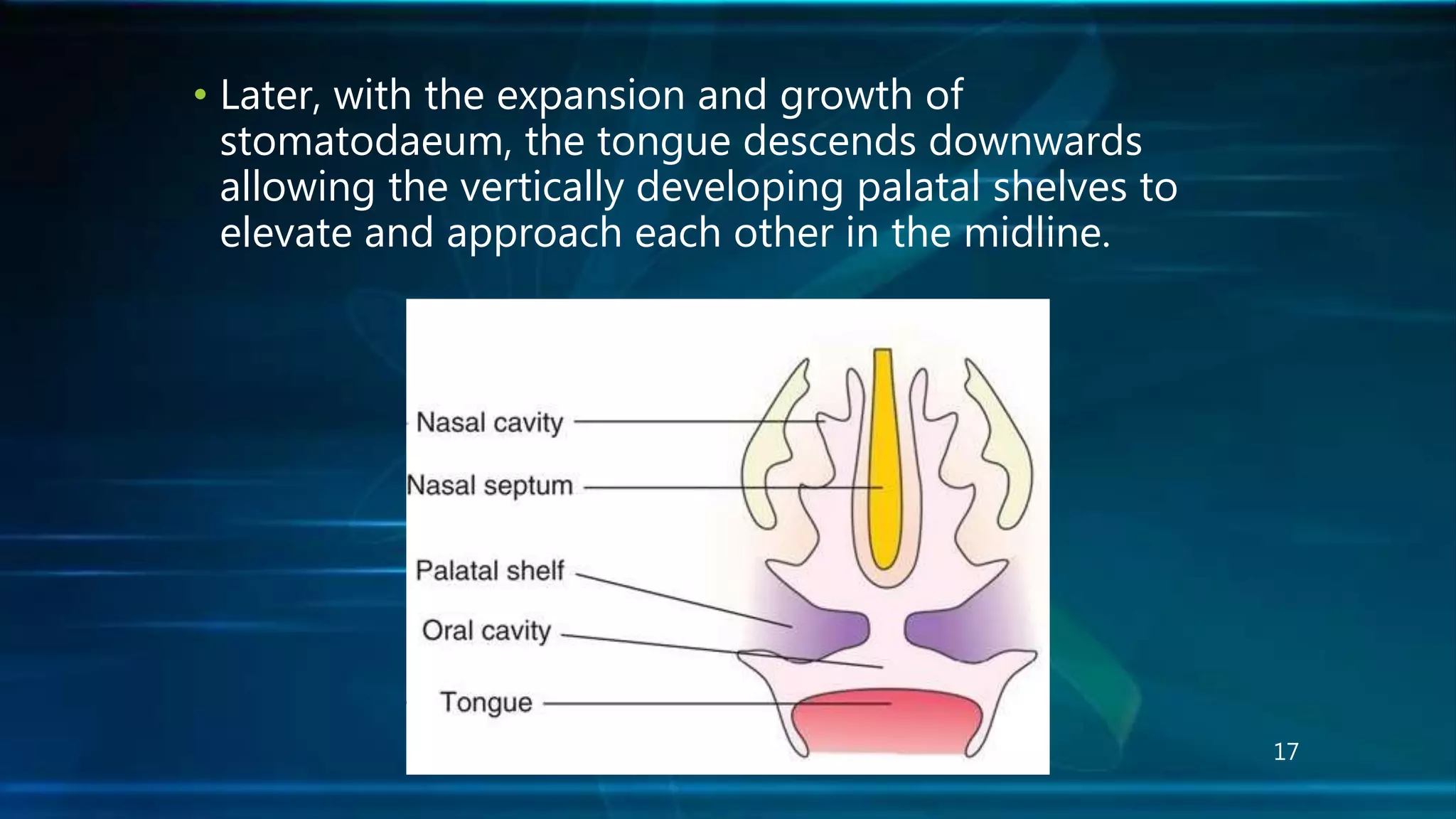 Cleft Lip and Cleft Palate | PPTX | Ear, Nose and Throat Conditions ...