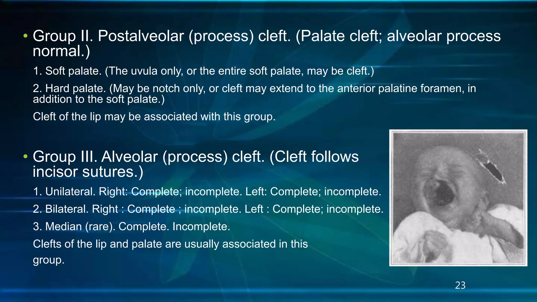 Cleft Lip and Cleft Palate | PPTX | Ear, Nose and Throat Conditions ...