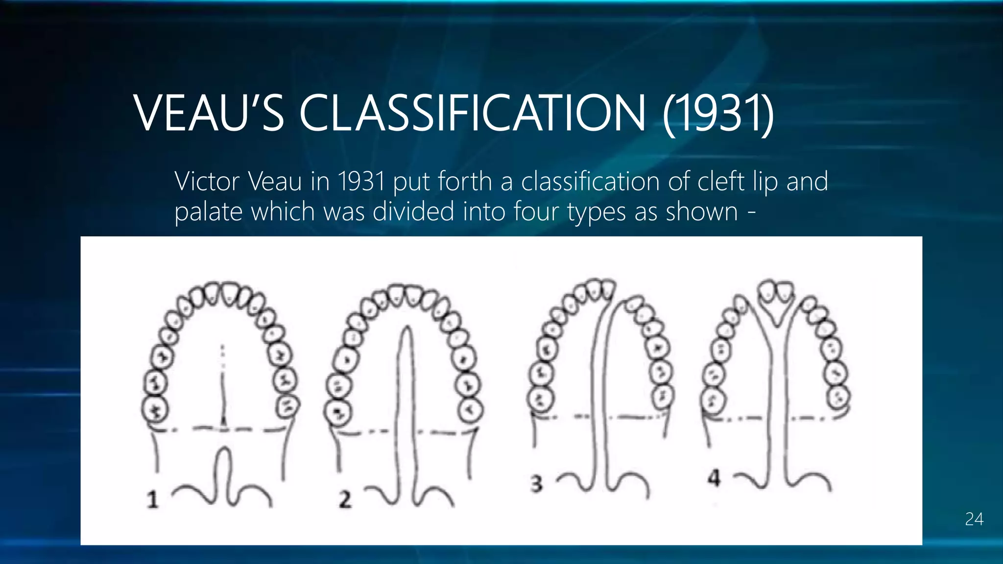 Cleft Lip and Cleft Palate | PPTX | Ear, Nose and Throat Conditions ...