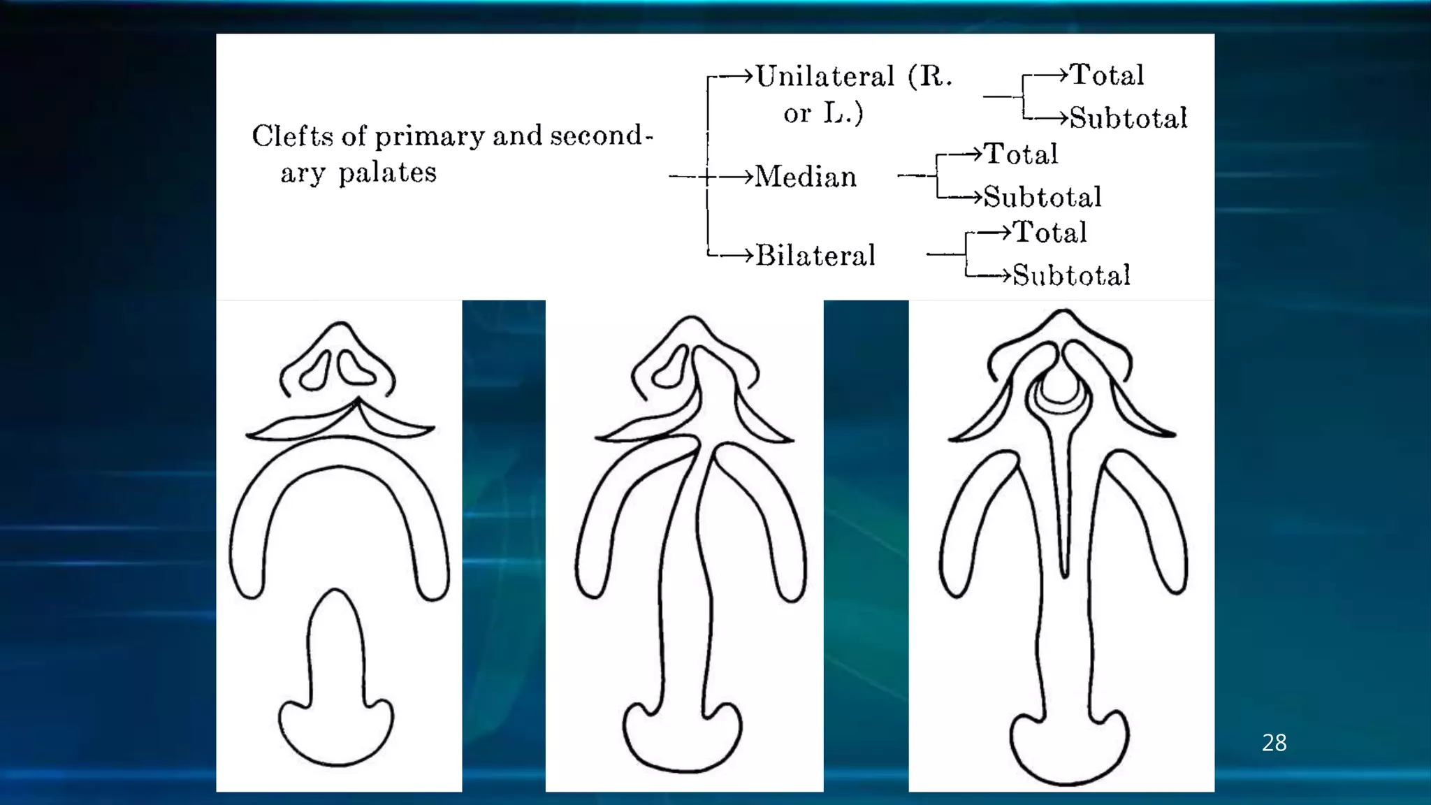 Cleft Lip and Cleft Palate | PPTX | Ear, Nose and Throat Conditions ...