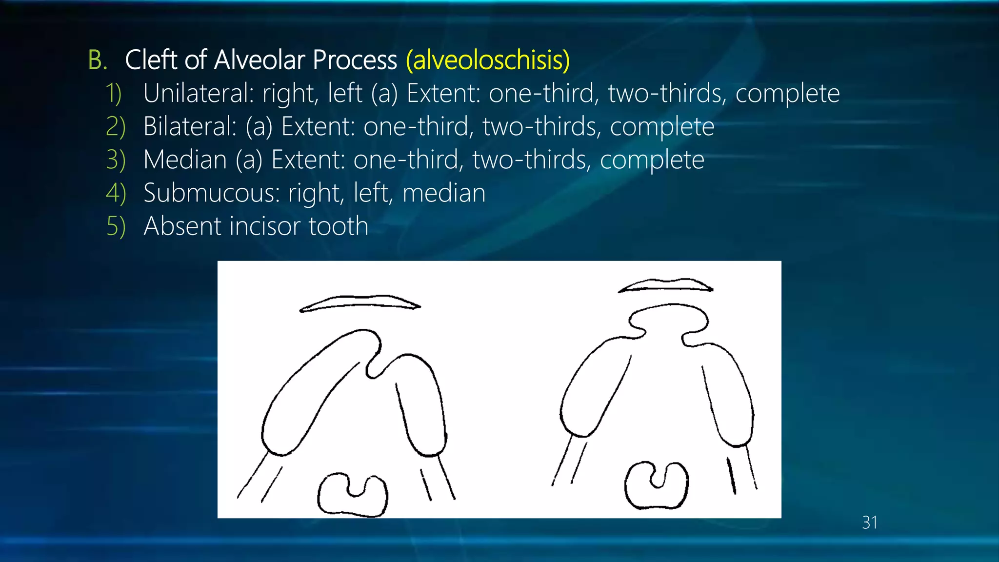 Cleft Lip and Cleft Palate | PPTX | Ear, Nose and Throat Conditions ...
