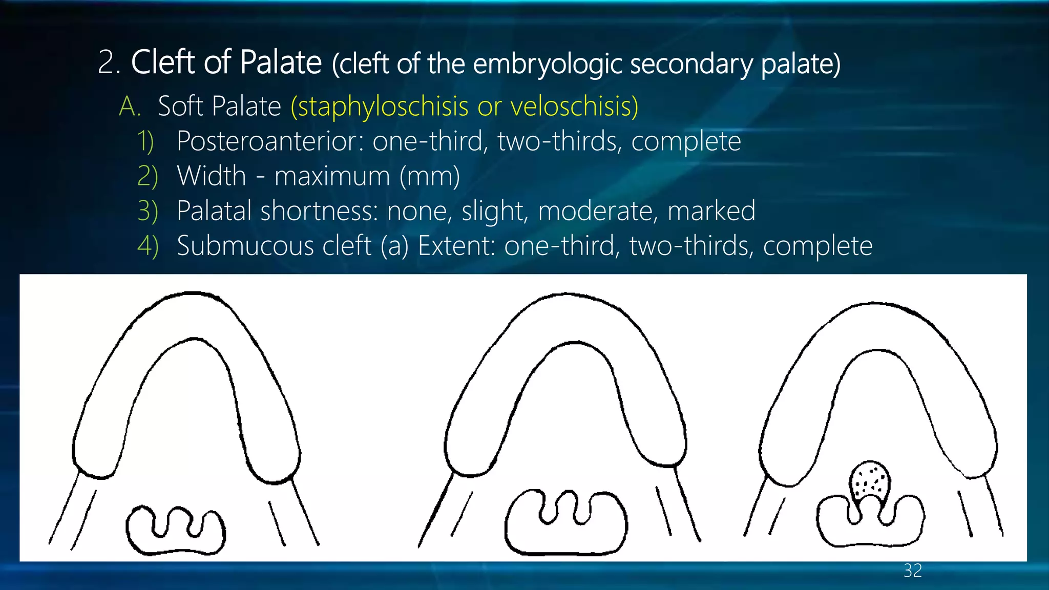 Cleft Lip and Cleft Palate | PPTX | Ear, Nose and Throat Conditions ...