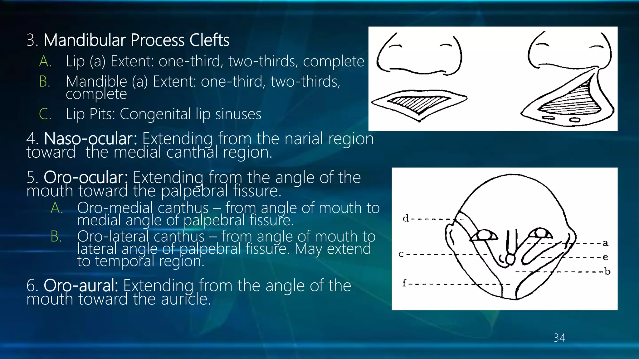 Cleft Lip and Cleft Palate | PPTX | Ear, Nose and Throat Conditions ...