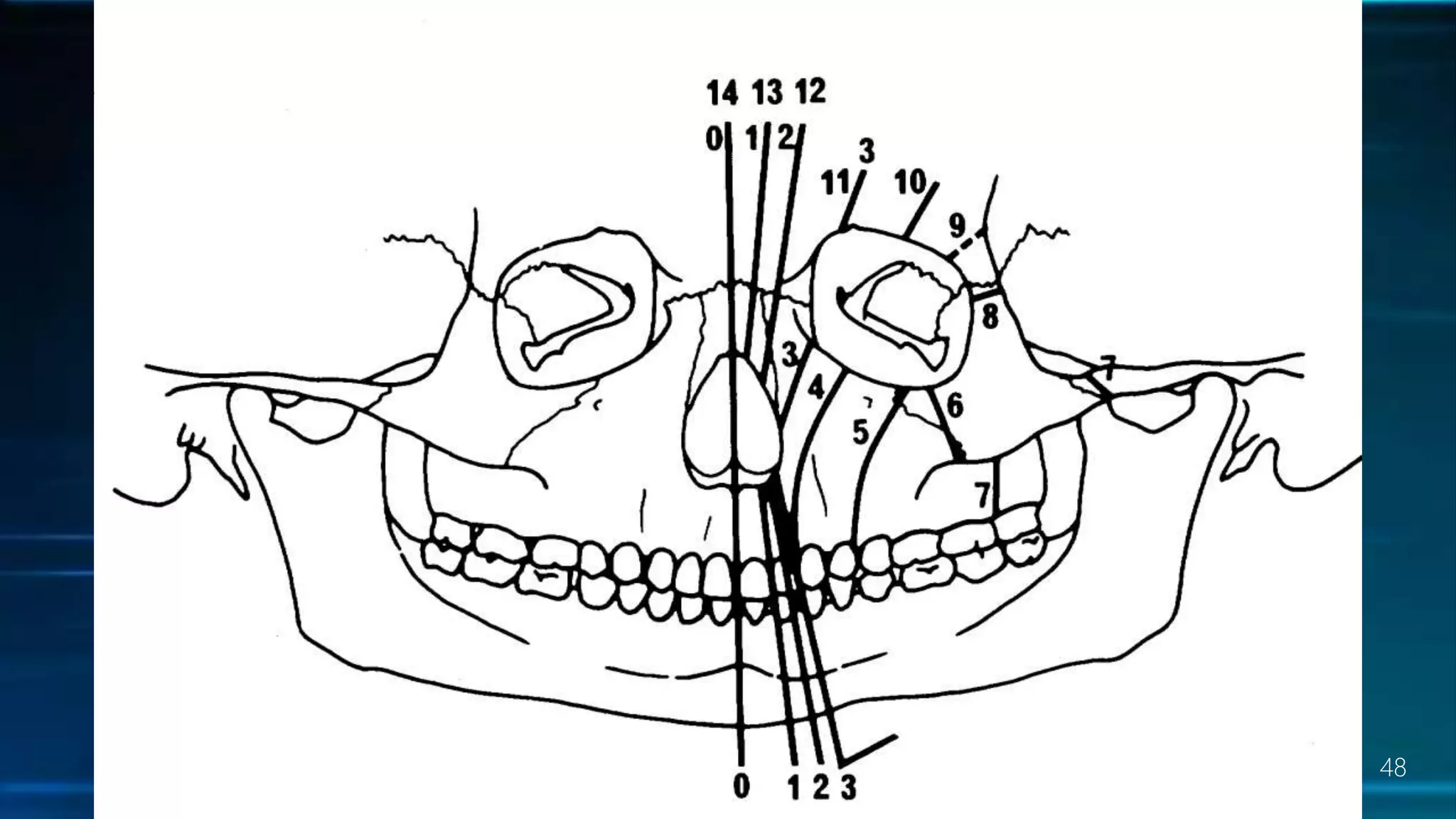 Cleft Lip and Cleft Palate | PPTX | Ear, Nose and Throat Conditions ...
